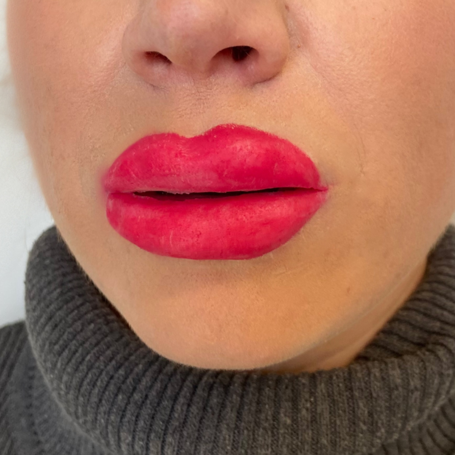 Botched Lips: Medium – The Prosthetics House