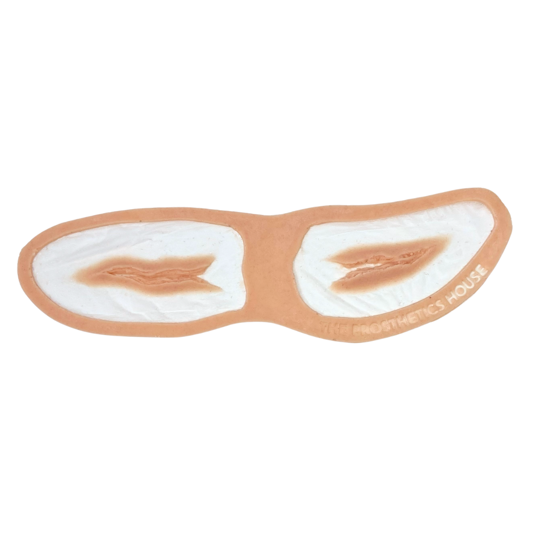The Chelsea Smile – The Prosthetics House