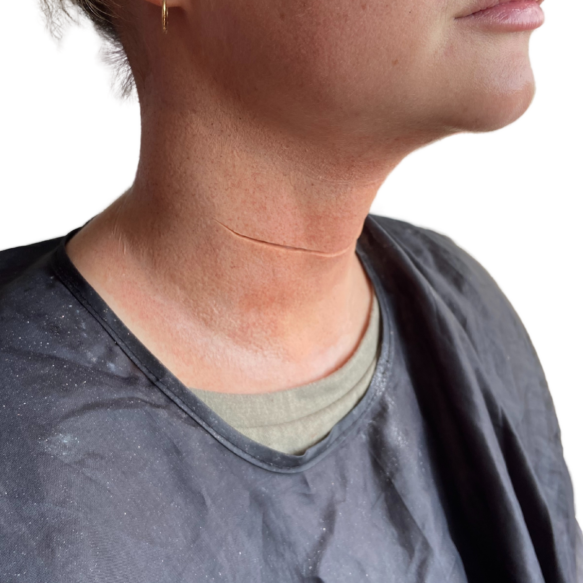 Slit Throat Prosthetic for Blood Rig Application – The Prosthetics House