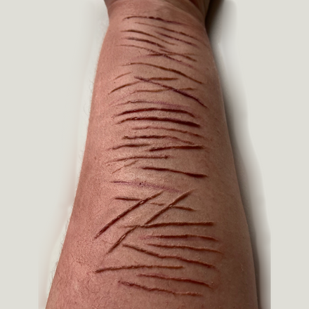 Products – The Prosthetics House