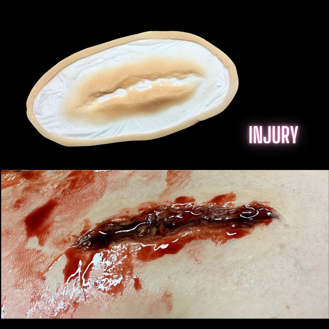 Skin Wound 10 | Silicone Prosthetics | SFX Make Up | Moulage – The ...